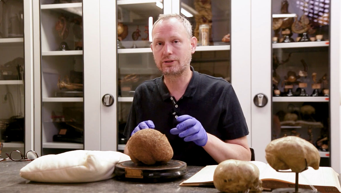 Museum Vrolik - Anatomy Stories: Graveyards & Curiosities - ONH.nl